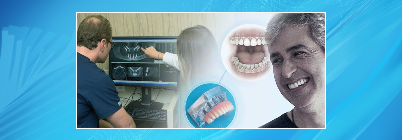 Engineering Principles | 1-877-886-1762 | FDG | OneSolution Dental Implants